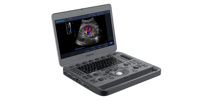 SONOSCAPE PORTABLE ULTRASOUND MACHINE X3